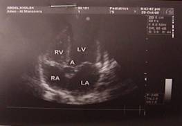 Criptoftalmia Bilateral - Caso Clínico. - Publicaciones de ...